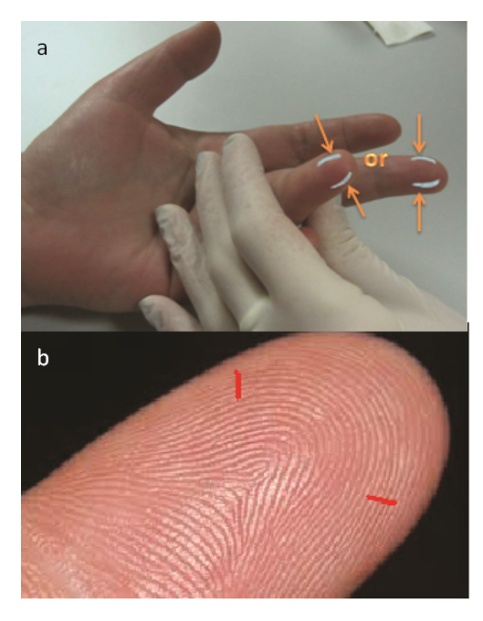 Capillary Collection Procedure